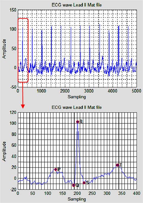 The Length Of A Normal Ecg Wave Download Scientific Diagram
