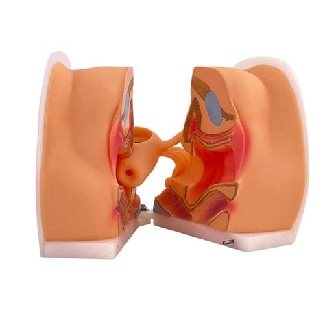Contraceptive Demonstration Model Medical Education Tool