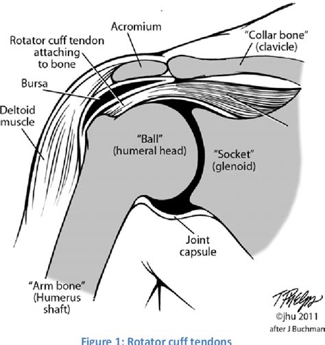 Figure 1 From A Patient Guide To Failed Rotator Cuff Repairs Semantic