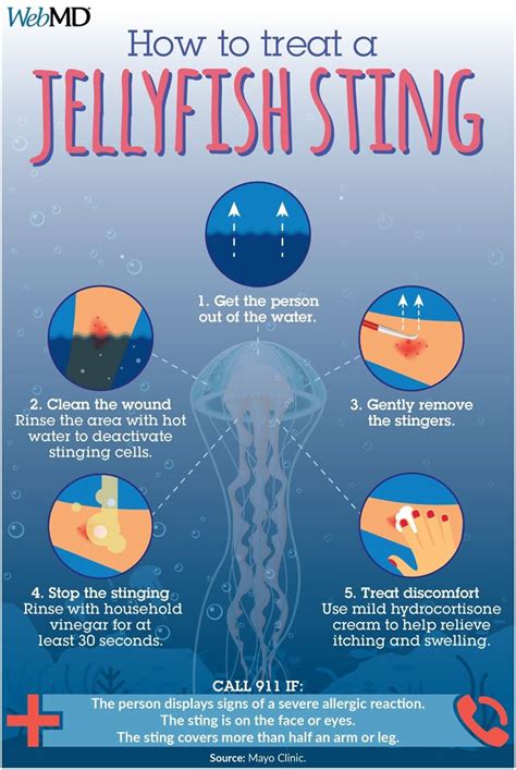 Jellyfish Stings Jellyfish Sting Jellyfish Facts Jellyfish