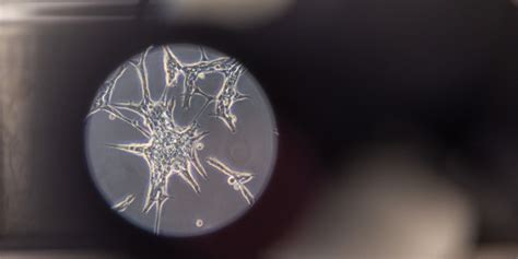 Mu Researchers Make Strides In Understanding Fetal Brain Development