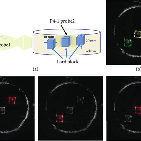 Schematic Of An Xrai And Us Dual Modality Imaging System Built On A