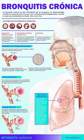 Vida Y Salud Hoy Entendiendo La Bronquitis Cronica