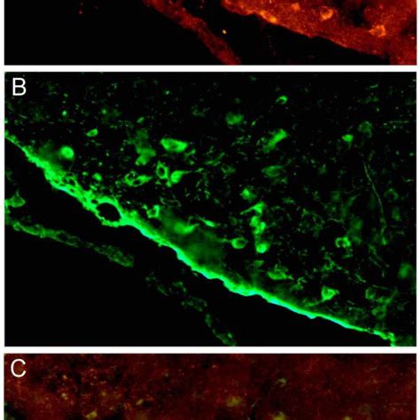 Immunostaining Of Hdc And Peripherin We Preformed Double Download