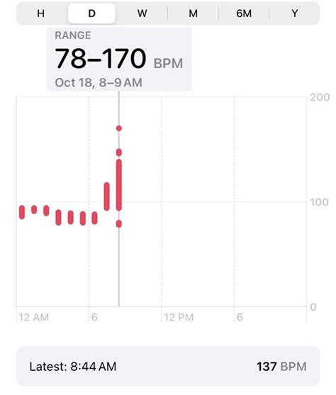 Heart Rate Spiking Rgravesdisease