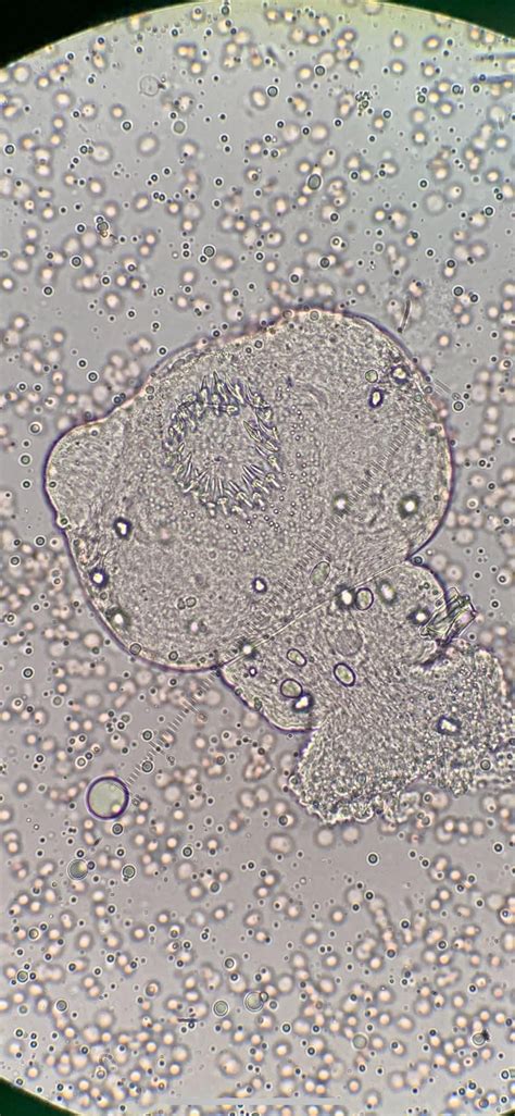 Echinococcus Rmicrobiology