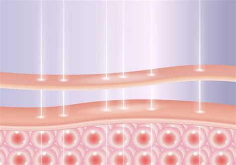 레이저 피부 재활용은 주름을 고치기 위해 피부 수리 개념 3d 렌더링 프리미엄 벡터