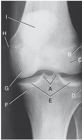 Ap Knee Radiograph Diagram Quizlet