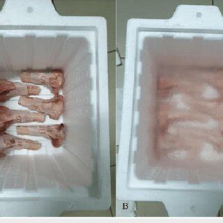 A Proximal Tibia Bone End With Individual Labelling Contained In Download Scientific Diagram