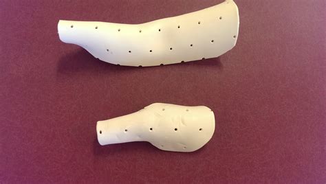 Orthoplast Splinting Orthoplast Splinting