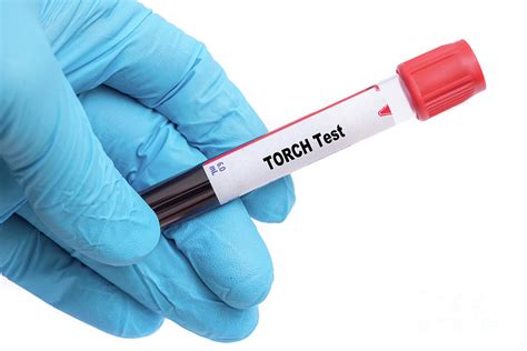 Torch Test Photograph By Wladimir Bulgar Science Photo Library Pixels