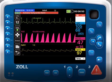 Capnography For Paramedics