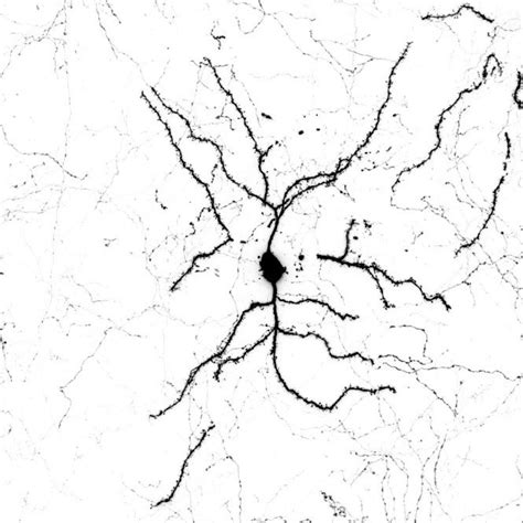 Rôle Du Polymorphisme Taqi1ankk1 Dans Le Contrôle Des Addictions Et Du
