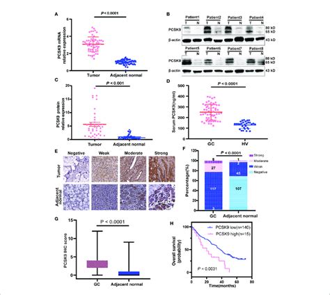 Increase Of Pcsk9 Expression In Gc A Pcsk9 Mrna Expression Levels