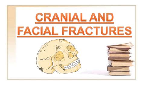Cranial And Facial Fractures Ppt