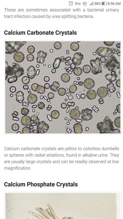 Calcium Carbonate In Plants Calcium Carbonate Under Microscope