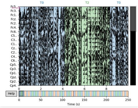 Raw Eeg Signals For Motor Imagery Class For Left And Right Hand Movements Download Scientific