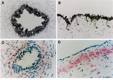 Figure 4 From Potential Biological Role Of Transforming Growth Factor Beta1 In Human Congenital