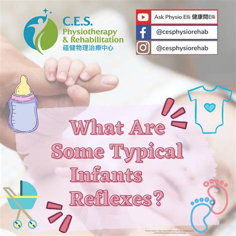 Special Topic What Are Normal Infant Reflexes
