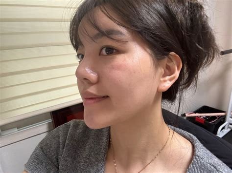 일산피부관리 속 당김부터 건조까지 슈퍼젝션으로 해결 네이버 블로그