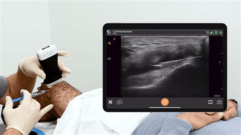 Msk Ai And Knee Joint Injection Clarius