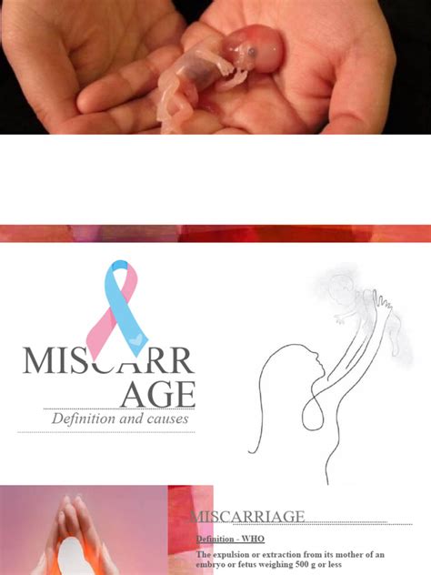 Miscarriage And Stillbirth Pdf Miscarriage Pregnancy
