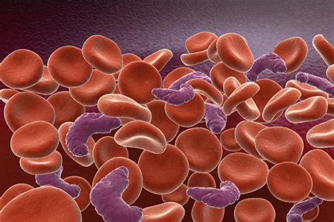 Lentiglobin Gene Therapy Shows Positive Results In Patients With Sickle