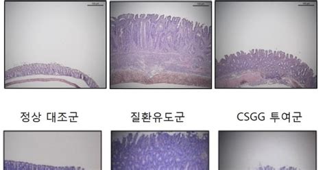 비피더스 장 속 염증 제거에 효과 있다신약 소재로 주목