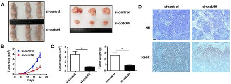 Circccdc66 Knockdown Inhibits Gastric Cancer Growth In Vivo A