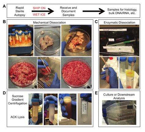 Isolating And Culturing Cells From Diffuse Intrinsic Pontine Glioma