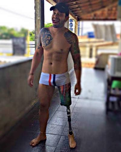 Sporting Yet Another Prosthetic Leg Tumbex