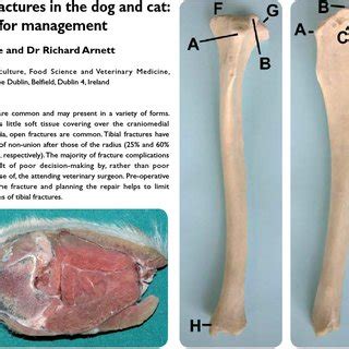 Cross Section Of The Right Proximal Tibia Download Scientific Diagram