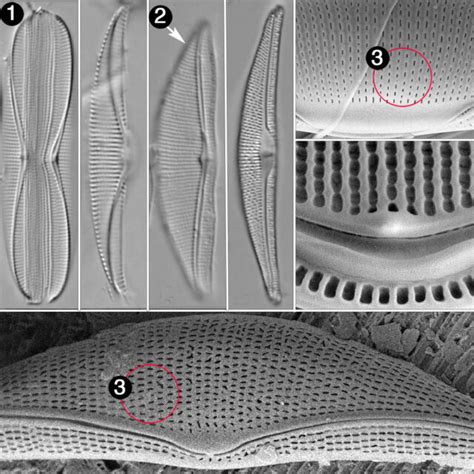 Tetramphora Genera Diatoms Of North America