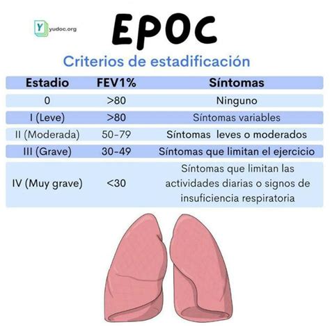 EPOC YUDOC ORG UDocz