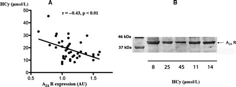 A Correlation Curve Pearson Between Plasma Homocysteine