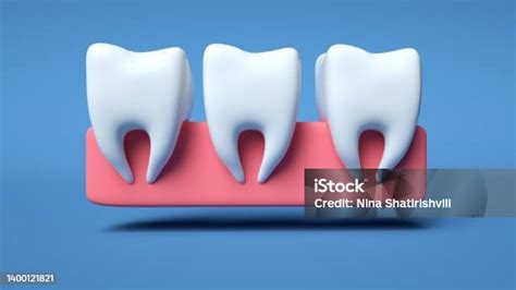 분홍색 잇몸에 건강한 치아 치과 건강 개념 3d 일러스트 레이 션 0명에 대한 스톡 사진 및 기타 이미지 0명 3차원 형태