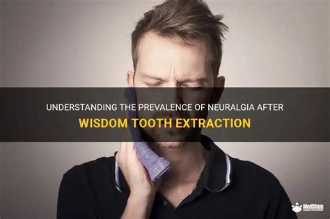 Understanding The Prevalence Of Neuralgia After Wisdom Tooth Extraction Medshun