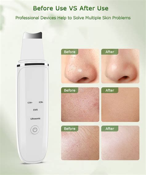 Badu Bg Alwafore Ultrasonic Skin Scrubber Deep Face Cleaning Machine Лопата за белене на лицето
