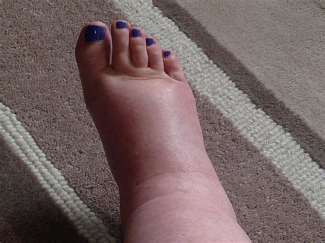 Shiny Fat Chubby Foot By Kungflew2013 On Deviantart