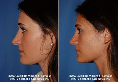 Flat Nose Tip