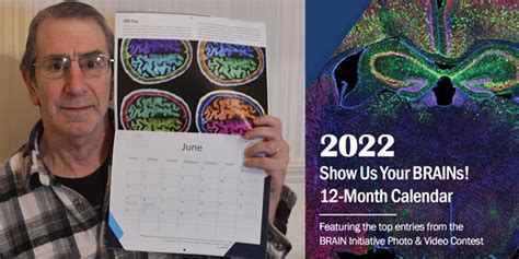 Eric H Chudler Uw Bioengineering