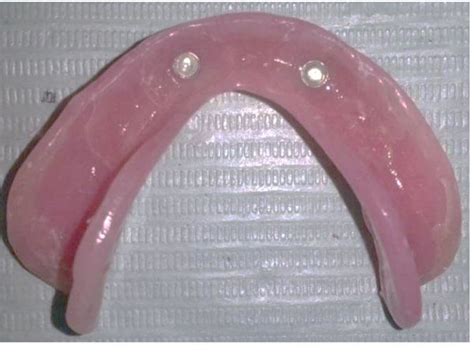 Picked Up Female Housing Of Ot Equator Attachment With The Clear Male