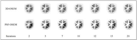 Optimization Of The Algorithm For The Implementation Of Point Spread Function In The 3d Osem