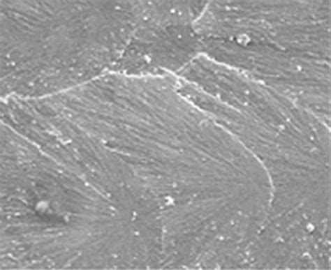 Sem Micrographs Of A Epoxy Resin B Epoxy Resin 5 Phr Enr 50 And Download Scientific
