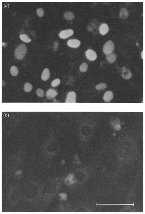 Indirect Immunofluorescence O F A L Cells Induced To Express Ie