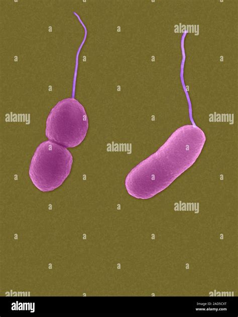 Coloured Scanning Electron Micrograph Sem Of Vibrio Parahaemolyticus Halophilic Facultative