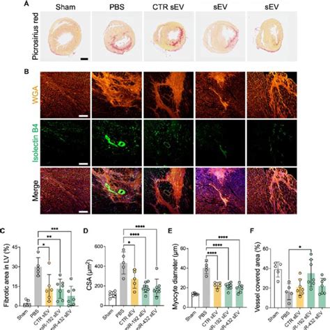 Histological Analyses Showed The Improved Ischemic Heart Function By