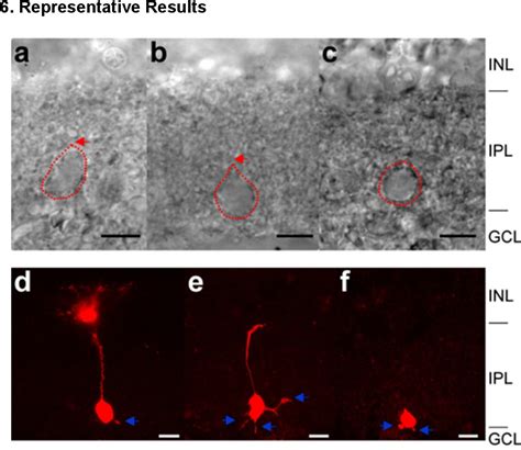 Figure 1 From Patch Clamp Capacitance Measurements And Ca²⁺ Imaging At Single Nerve Terminals In