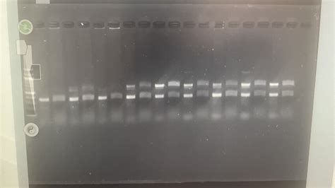 Why Are There Two Bands In Some Of My Pcr Product And Why Are Bands For Restriction Digest Large