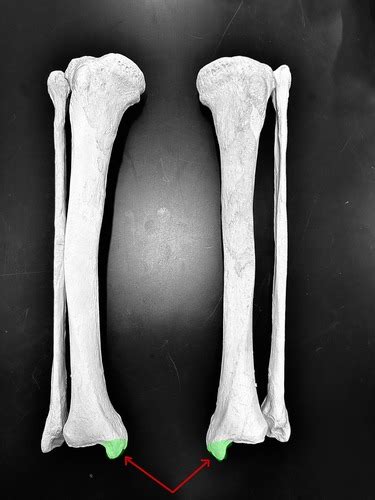 Lab 2 Tibia Fibula Flashcards Quizlet